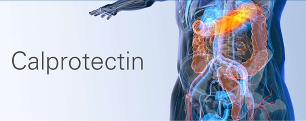 News - Fecal Calprotectin: An Important Tool for the Differential ...